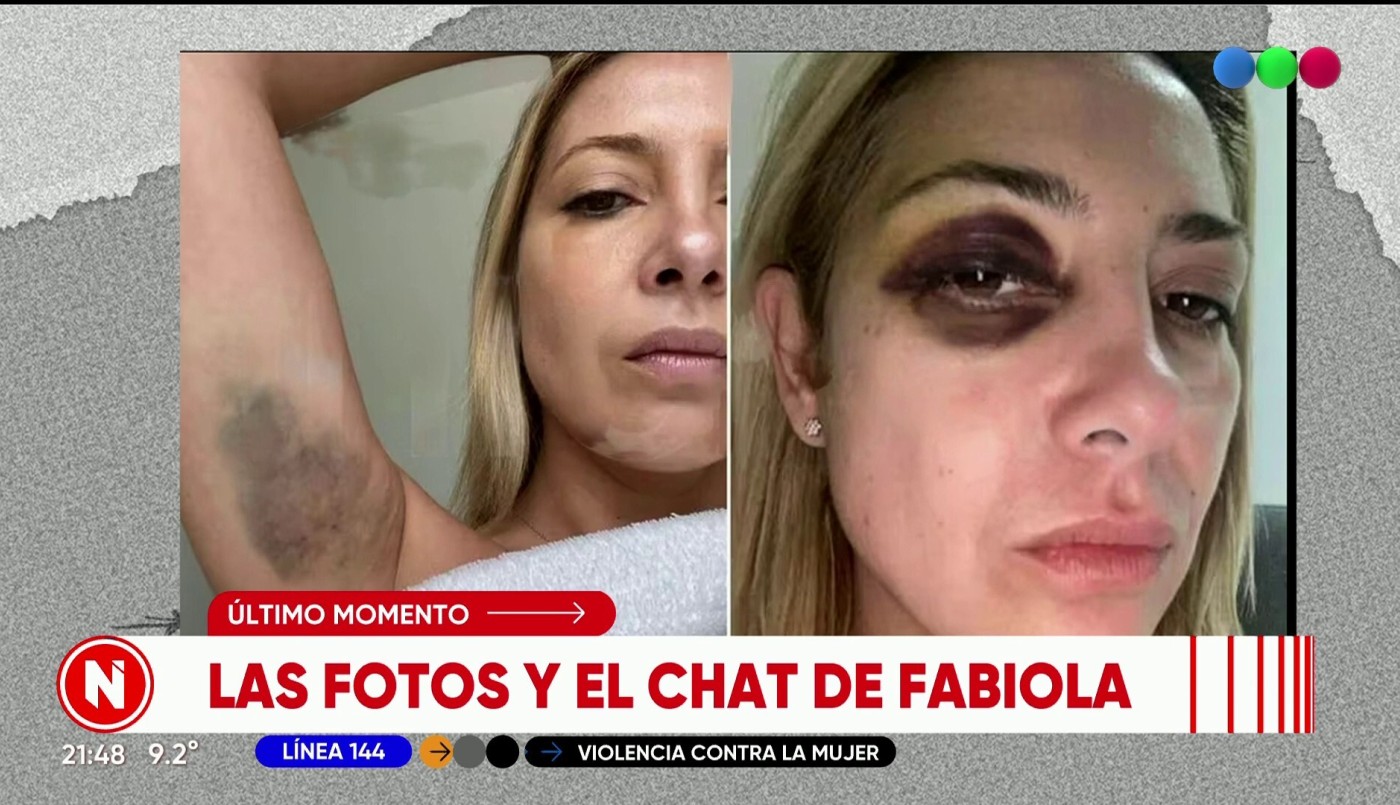 Difunden las fotos de la agresión de Alberto Fernández a Fabiola Yáñez ...
